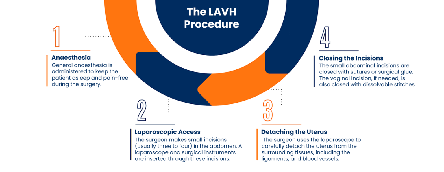 Laparoscopically Assisted Vaginal Hysterectomy Surgery in India | TAH ...
